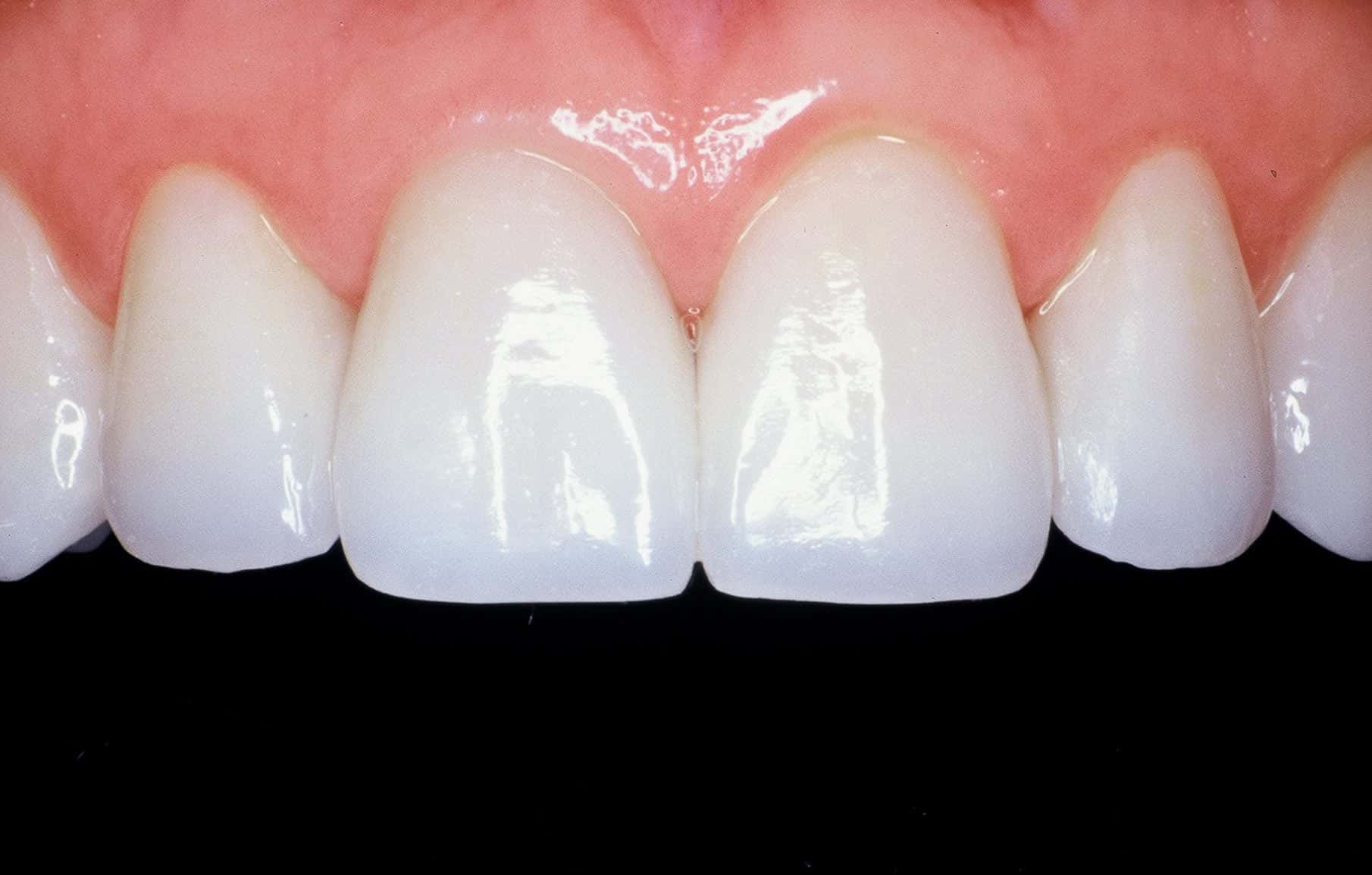 Cosmetic Dentistry Consultation | Dr. Chris Catalano