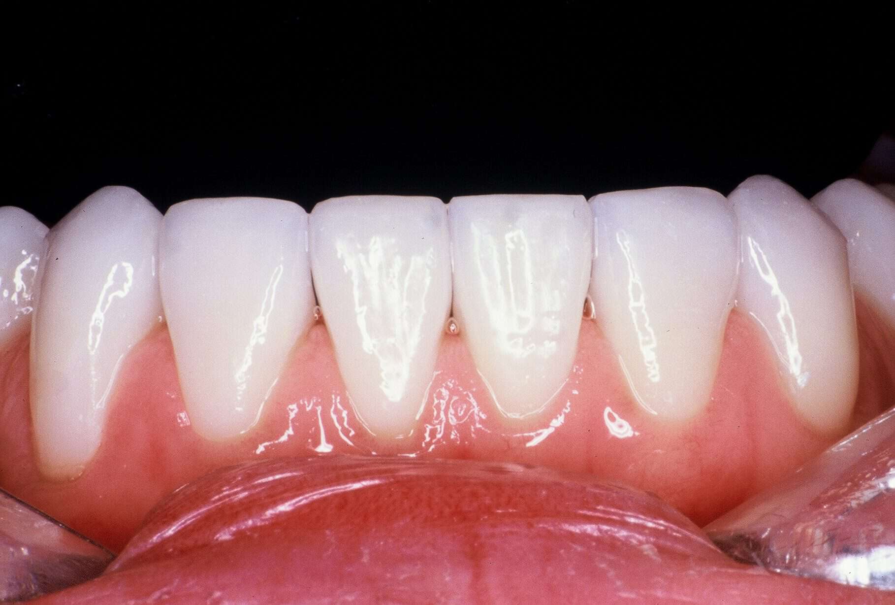 Cosmetic Dentistry Consultation | Dr. Chris Catalano